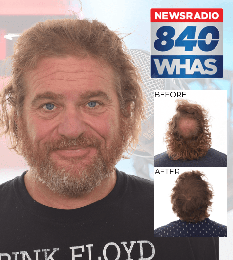 VIPS - We Grow Hair Indy