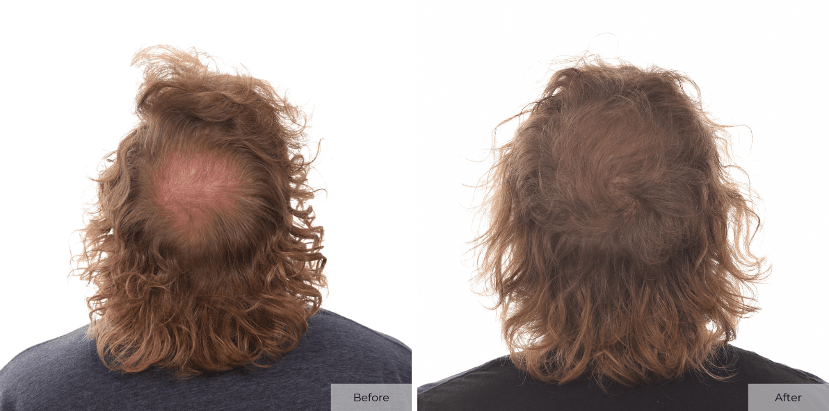 Dwight Witten - We Grow Hair Indy