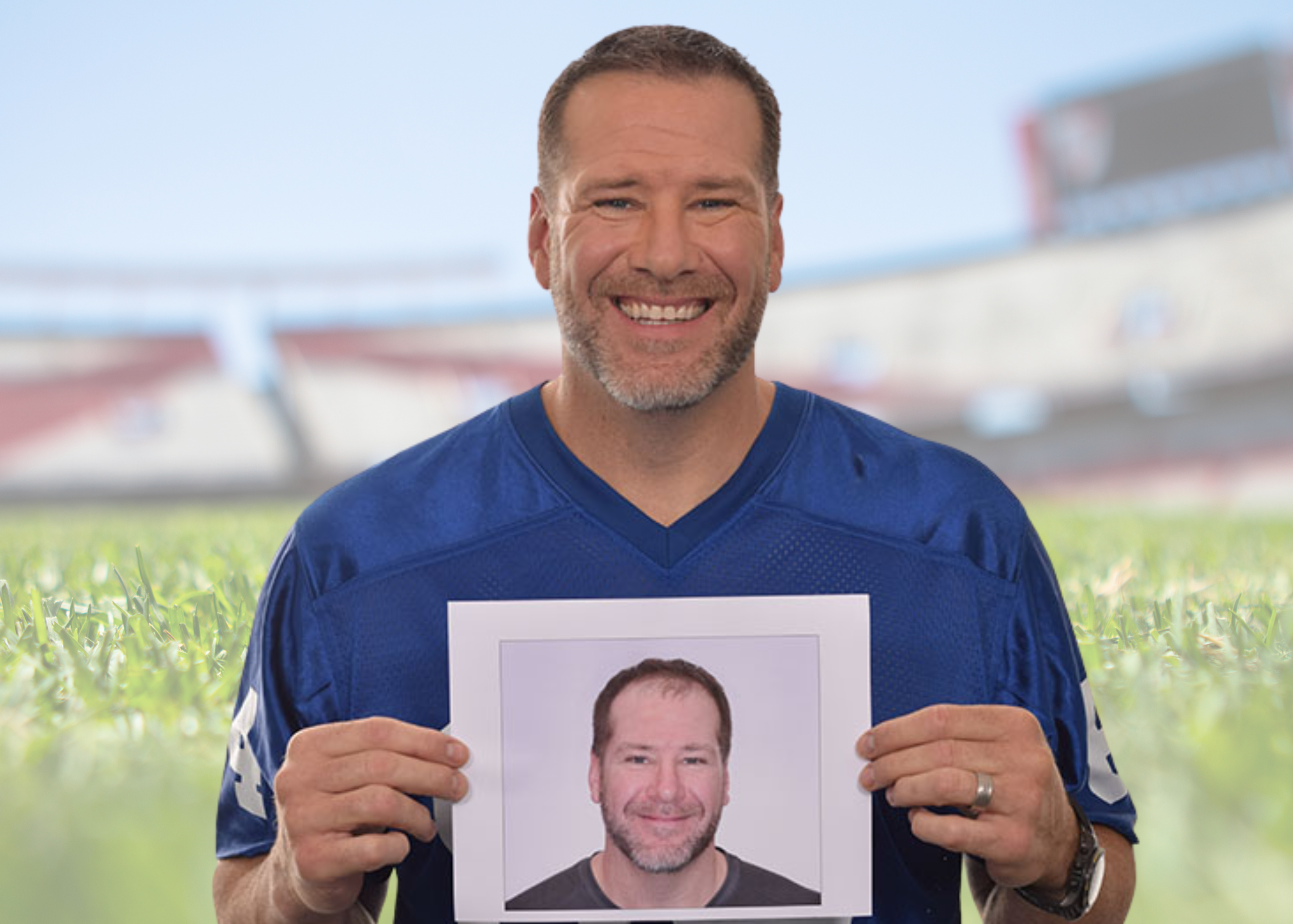 Colts Alumni Rick DeMulling & Barry Krauss on Hair Restoration - We ...