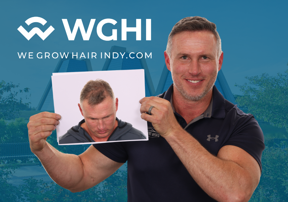 Hair Restoration Solutions - We Grow Hair Indy