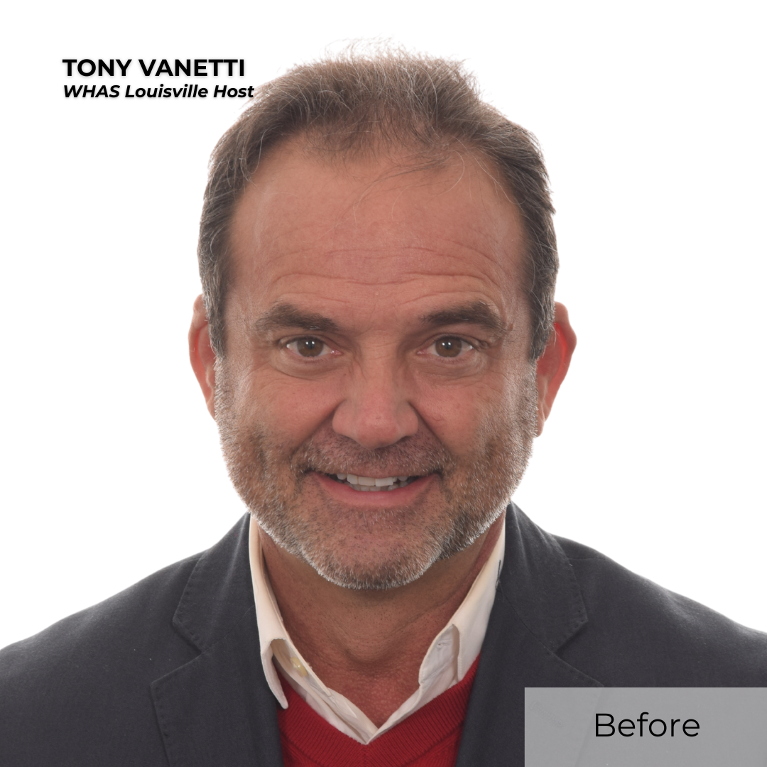 We Grow Hair Indy - Hair Transplant & Hair Restoration Experts